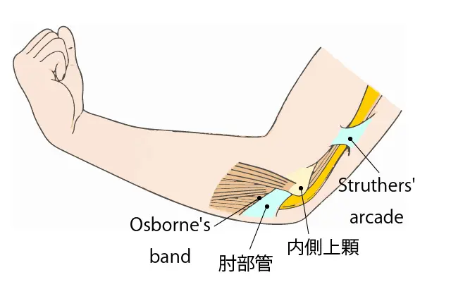 内側型野球肘の効果的な対策とリハビリ方法